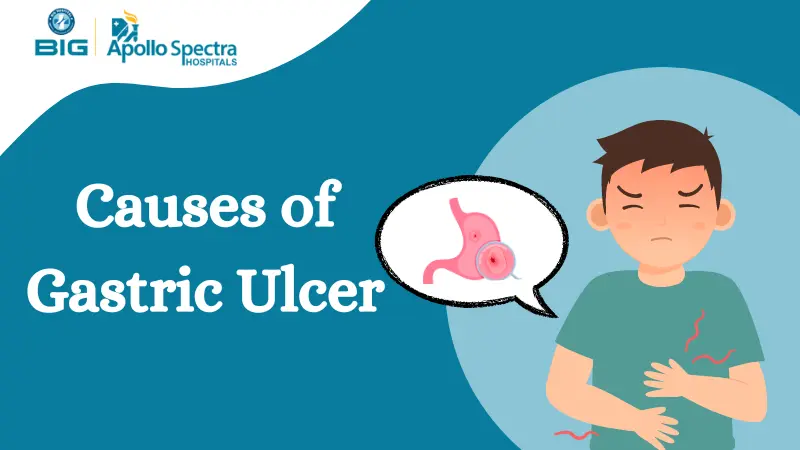8 Common Causes of Gastric Ulcer that Everyone Should Know